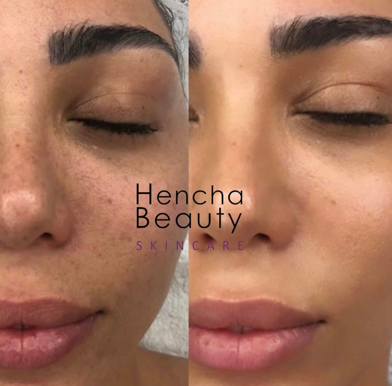 HENCHA BEAUTY SKINCARE PACKAGE